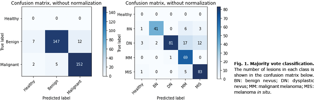 Hyperspectral analysis