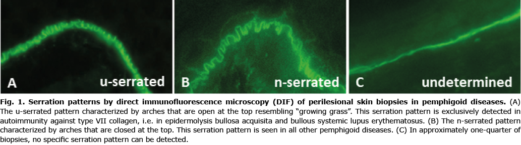 Bullous Pemphigoid Immunofluorescence